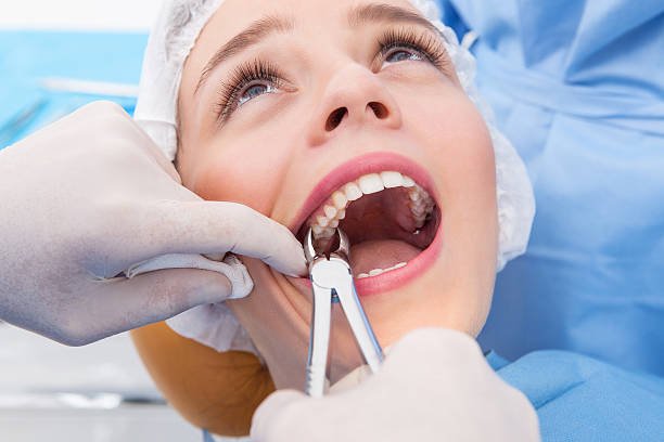 Tooth Removal - implantsquare.com